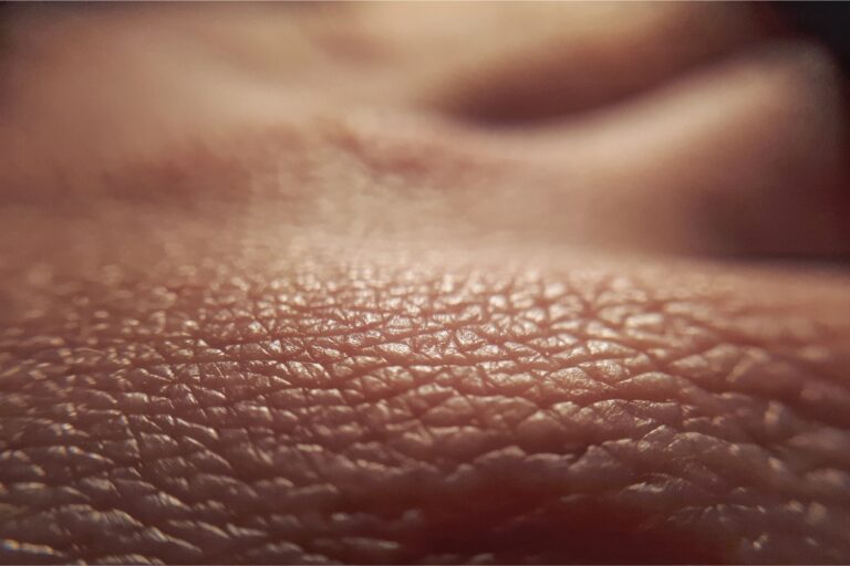 Skin Assessments - YorkOHS